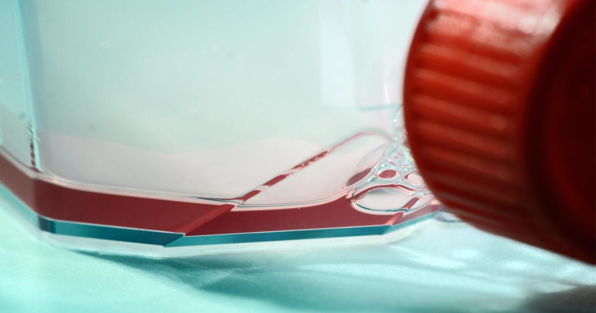 Cell line authentication | Genome Analysis | University of Helsinki