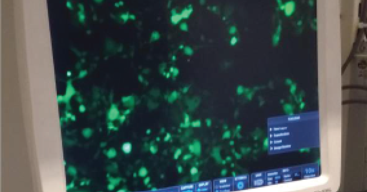 AAV Core Unit | Genome Editing, Function and Stem Cell Platform ...