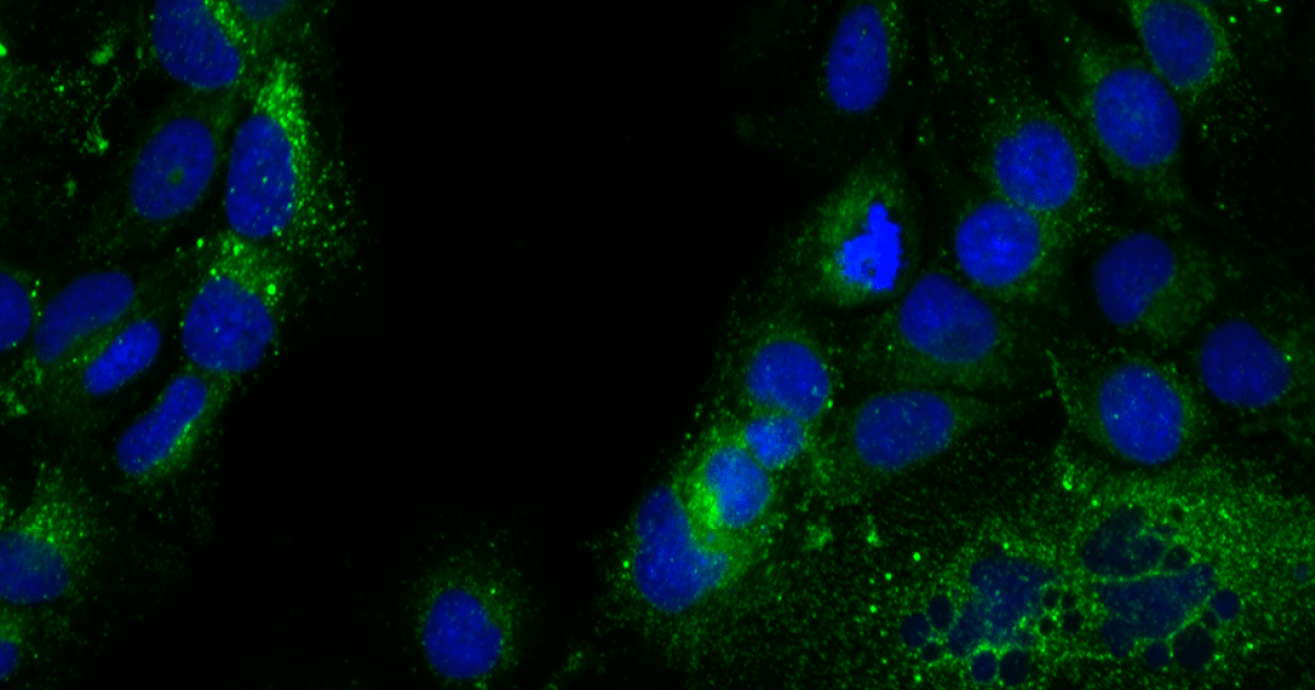 Researchers have taken AI-based biological image analysis to a new ...