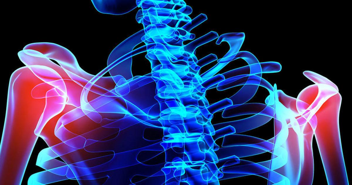 Finnish study shows that most common shoulder operation is no more ...