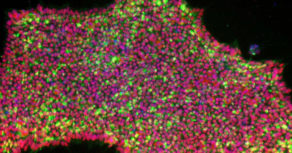 Researchers develop a new method for turning skin cells into ...