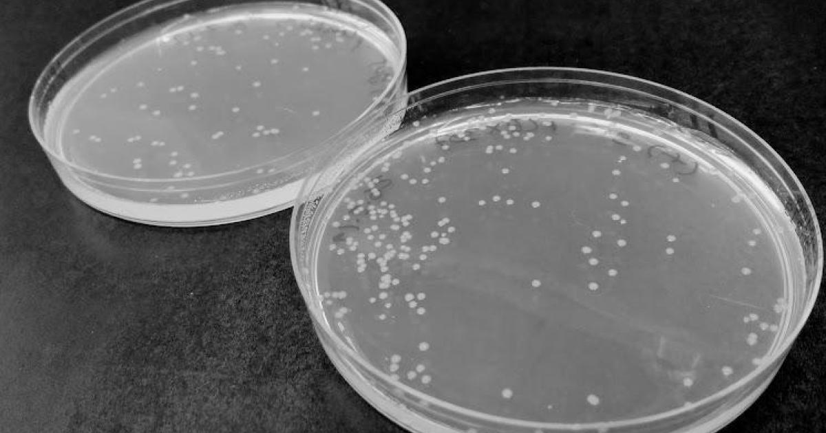 Clones and Cloning | Genome Biology Unit | University of Helsinki
