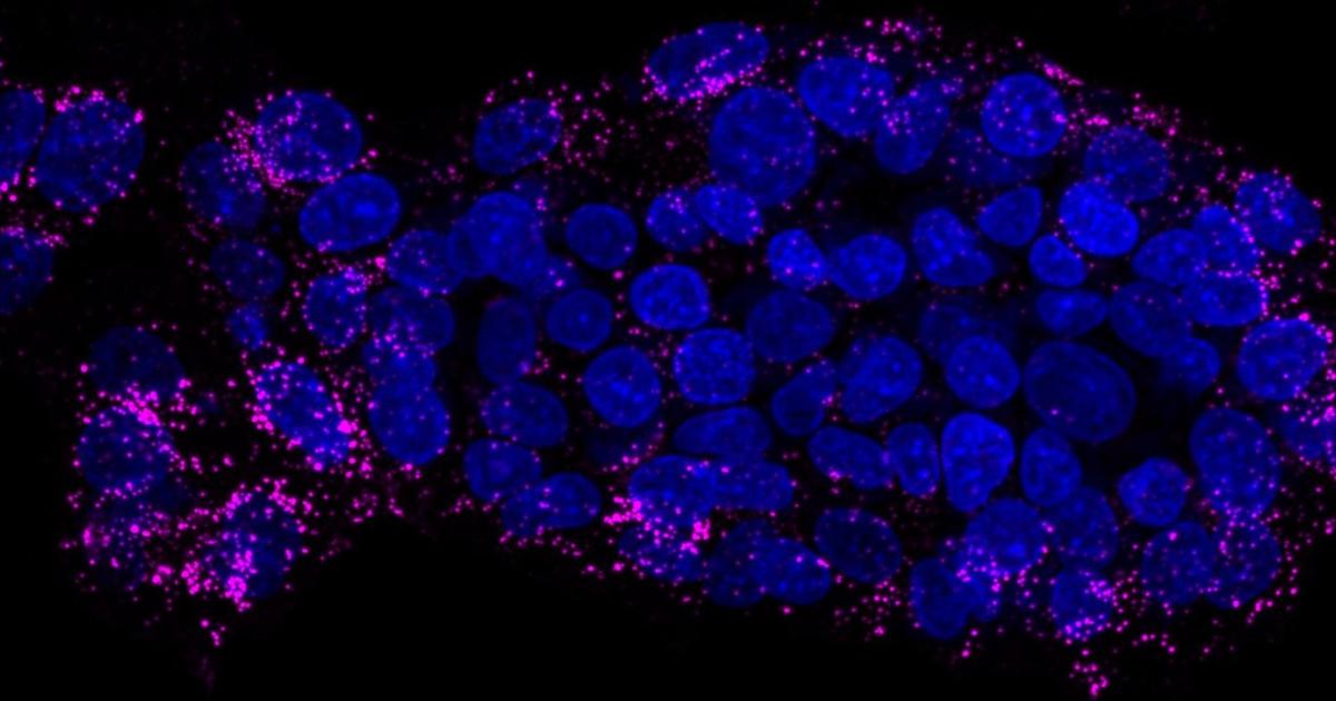 Functional cell profiling | University of Helsinki