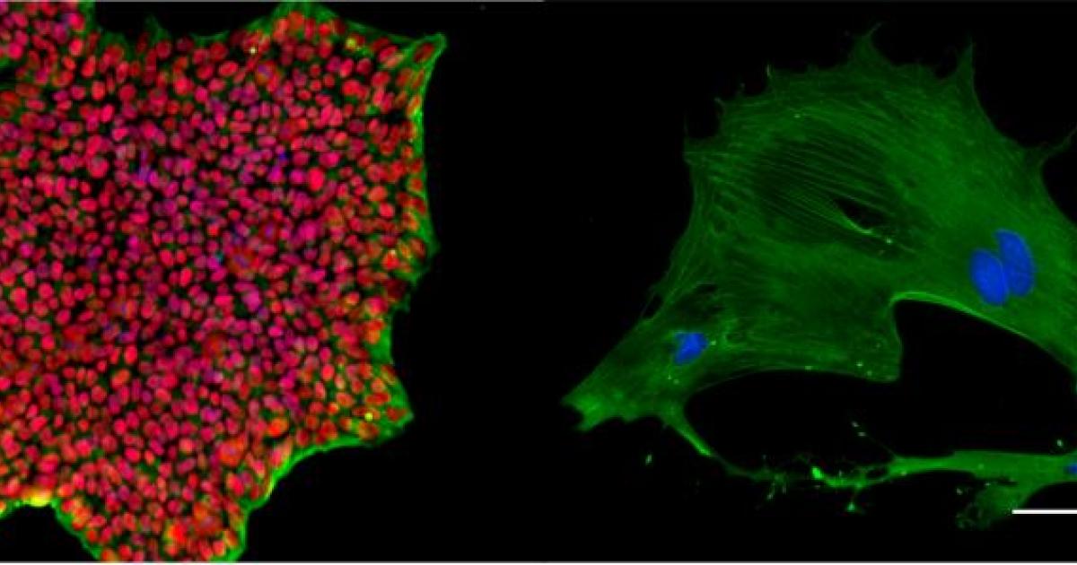Stem Cells And Metabolism Research Program University Of Helsinki
