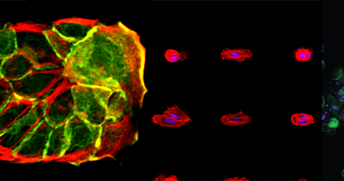 Stem cells and tissue architecture | University of Helsinki
