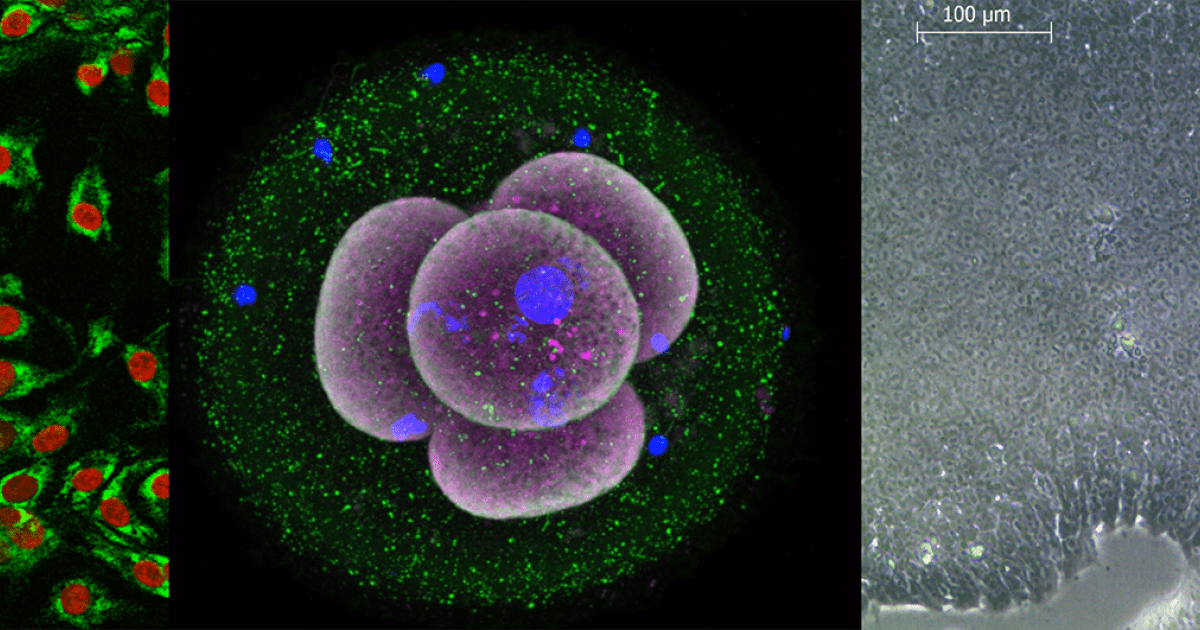 ReproHealth | University of Helsinki