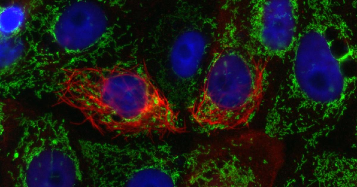 Viral Zoonoses Research Unit | University of Helsinki