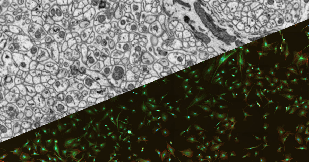 Bioimaging | University of Helsinki