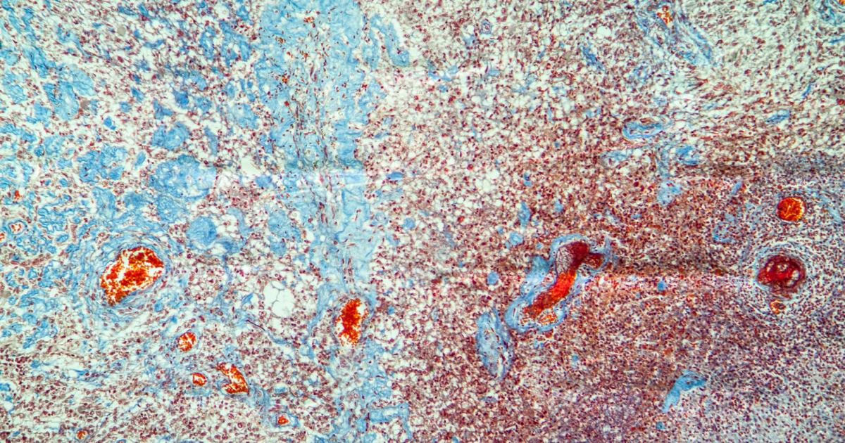 An AI model reveals how the body’s defence system recognises skin ...