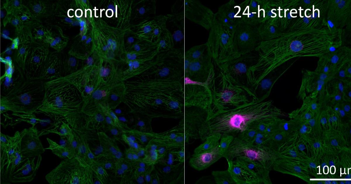 New article: Transcriptomic response of human pluripotent stem cell ...