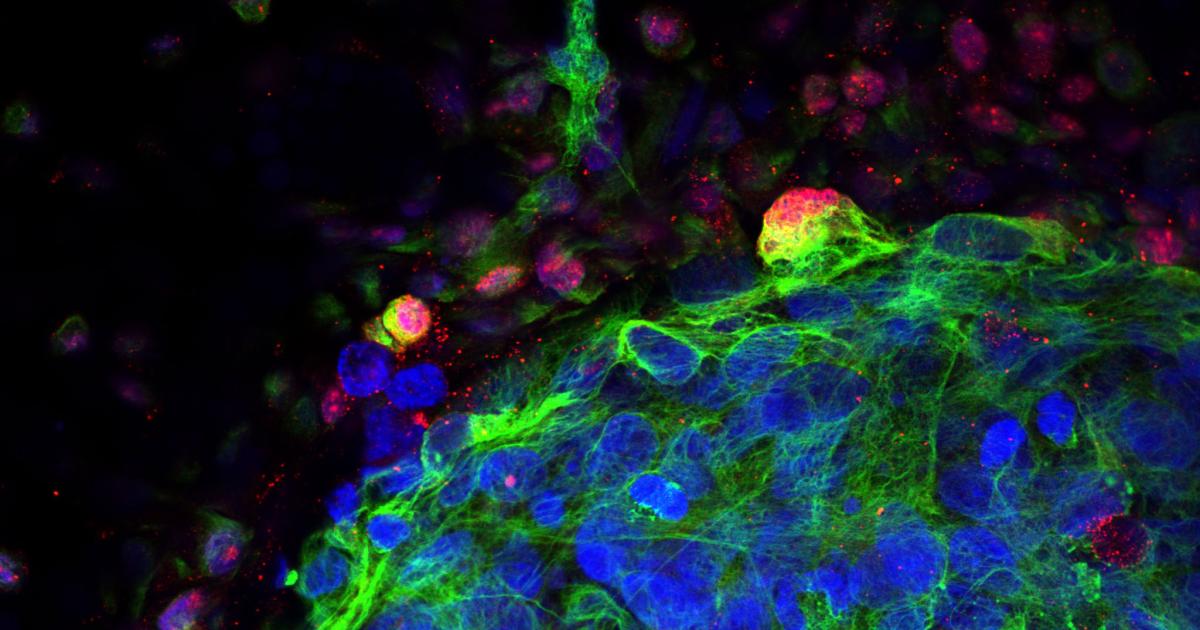 ReCurE is developing gentler cancer drugs as an alternative to ...