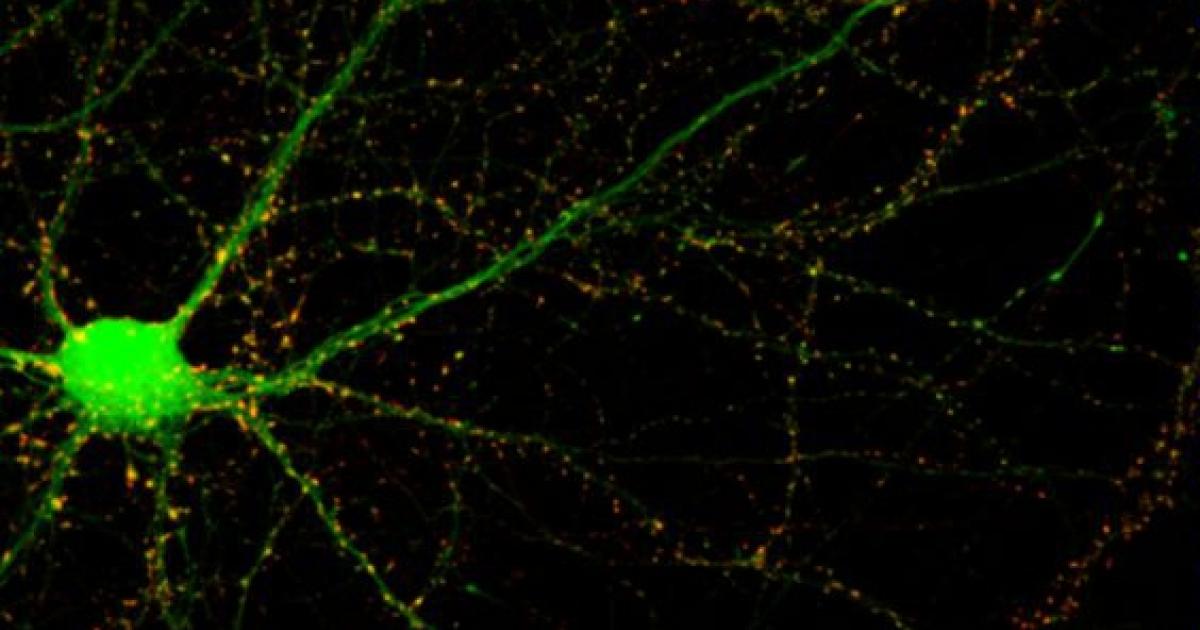 Synaptic Plasticity and Development | University of Helsinki